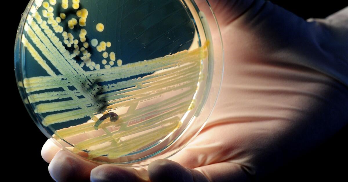 Behörden nach Ehec-Infektionen alarmiert – wie gefährlich sind sie? | 1&1