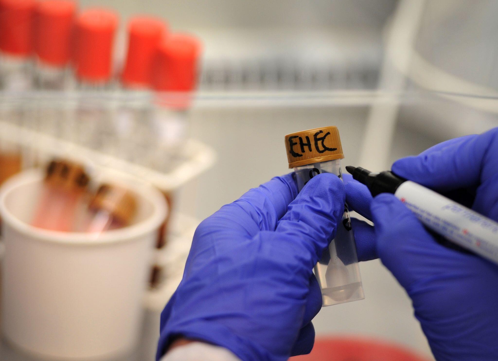 Rückruf von Rinder-Salami - Warnung vor Darmproblemen | 1&1