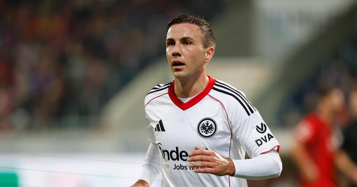 Mario Götze spricht über Haar-Transplantation | 1&1